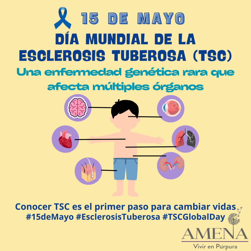 Complejo de Esclerosis Tuberosa – Asociación Mexicana de Epilepsia en Niños y Adultos